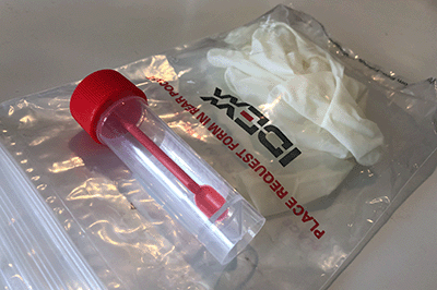 Fast Fecal Facts & Stool Sample Steps